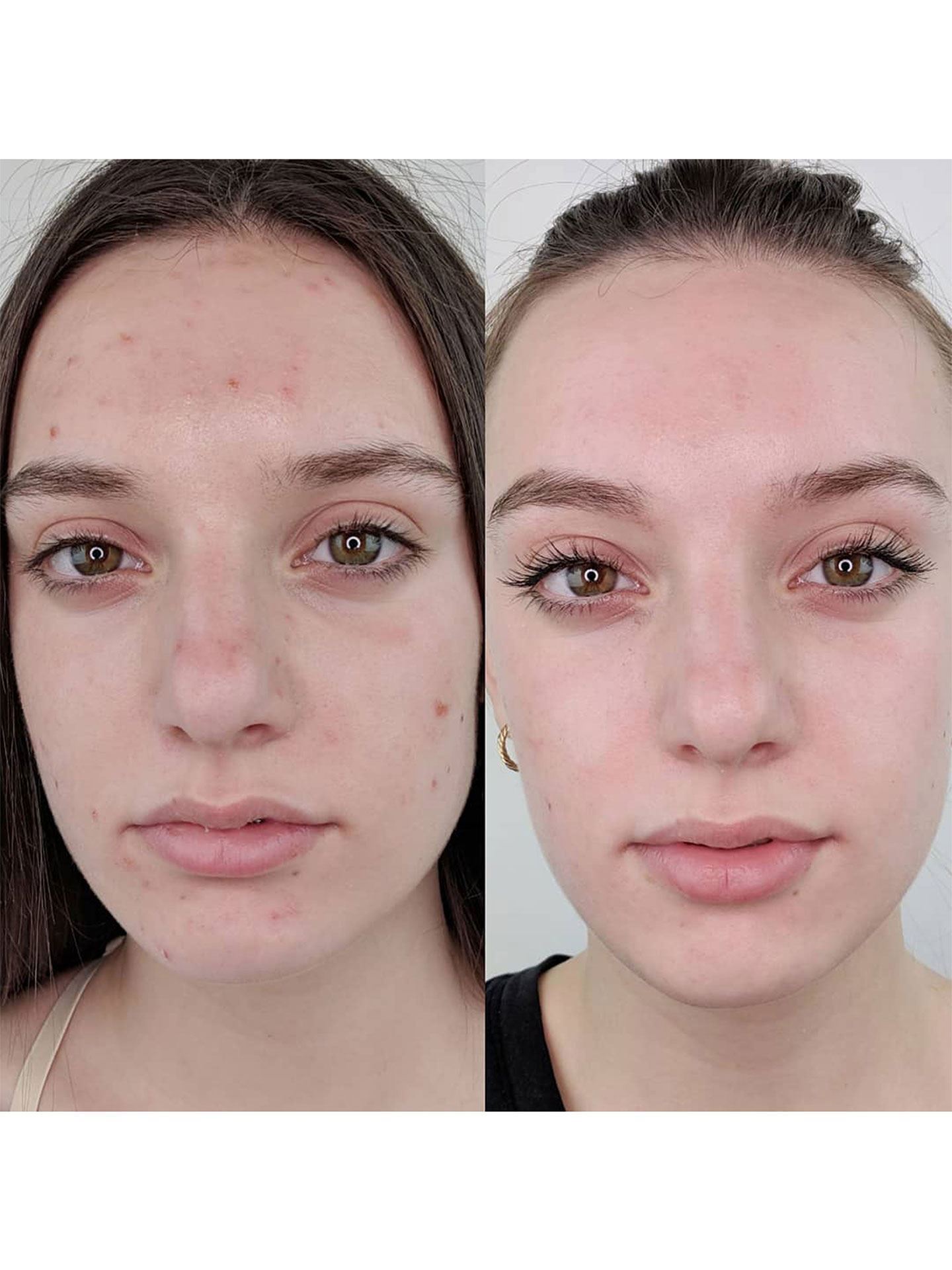 Mint Exfoliate Facial Polish | LIZstetique: Make-Up and Skincare